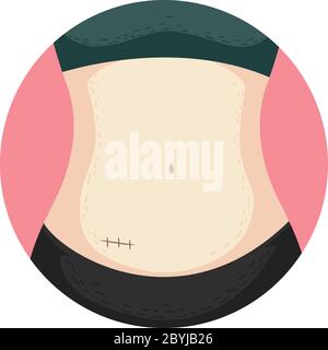 Illustration of a Woman Showing Belly With Stitches From Cesarean ...
