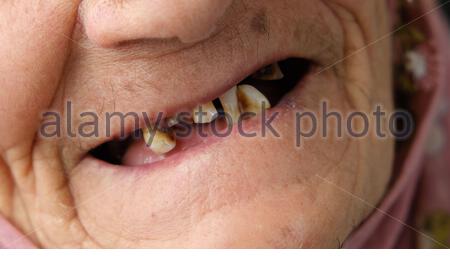 old woman without teeth, old woman with a few teeth in her mouth Stock ...