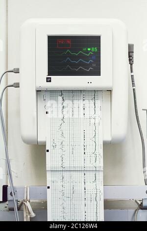 Close up of a fetal monitor or non stress test printing baby heartbeats ...