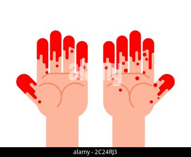 Hands palm paint drip splatter. Stain horror drops. Paint splash and ...