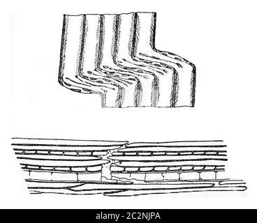 COMPRESSION FRACTURE, DRAWING Stock Photo - Alamy