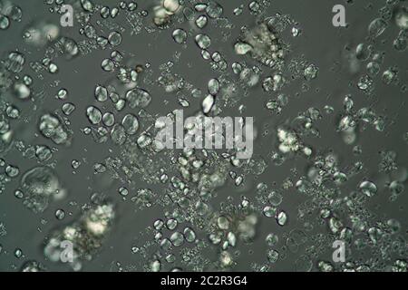 Cereal starch grains under the microscope 200x Stock Photo - Alamy