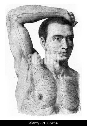 The muscles of the arm of the man hand being lifted, vintage engraved ...