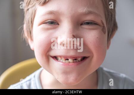 Toothless boy smiling Stock Photo - Alamy