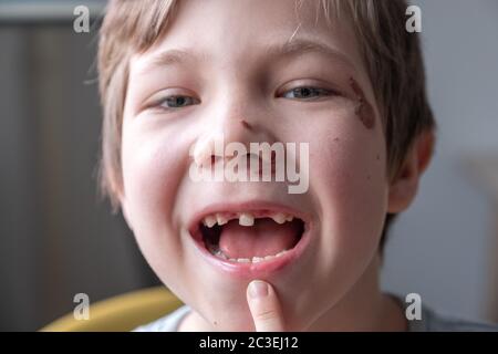 Toothless boy smiling Stock Photo - Alamy