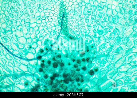 Microscope view of Fern Sporophyte Stock Photo - Alamy