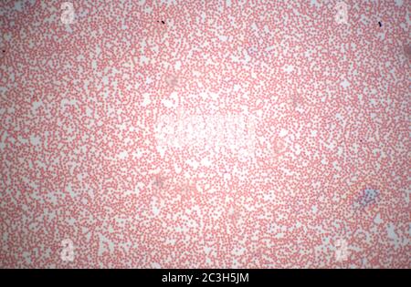 Microscope slide smear sample of human blood cells Stock Photo - Alamy