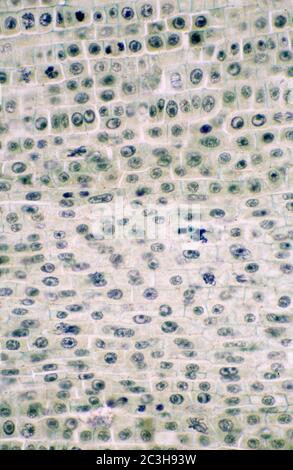 Vicia Fabia root tip mitosis transverse section Stock Photo - Alamy