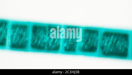 Spirogyra fresh water algae, microscope view Stock Photo - Alamy