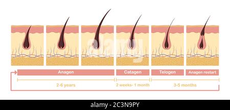 Hair growth cycle from Anagen to Catagen, and Telogen. Poster about ...