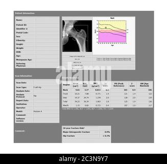 Osteopenia present. DEXA bone density scan, densitometry Stock Photo ...