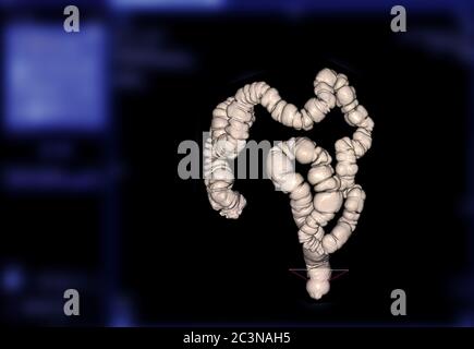 CT colonography or CT Scan of Colon 3D Rendering image blue color AP ...
