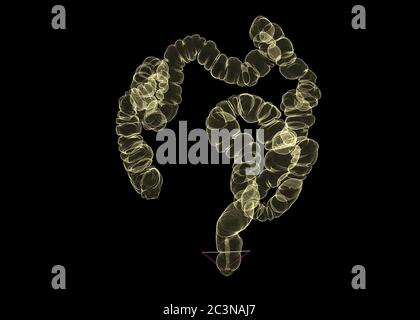 CT colonography or CT Scan of Colon 3D Rendering image for screening ...