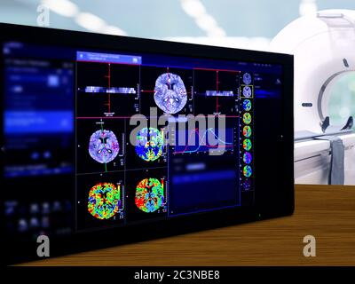 Brain Perfusion or CT scan of Blood flow in the brain 3d rendering ...