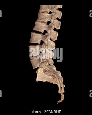 CT Lumbar spine or L-S spine 3D rendering image AP and Lateral view ...
