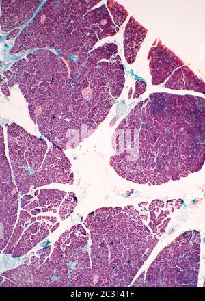 Pancreas, stained thin section, microscope view Stock Photo - Alamy