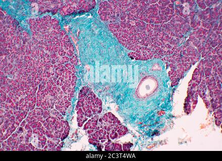 Pancreas, stained thin section, microscope view Stock Photo - Alamy