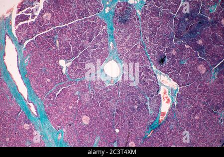 Pancreas, stained thin section, microscope view Stock Photo - Alamy
