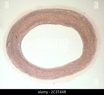 Cross section of animal Aorta, the main artery, microscope view Stock ...