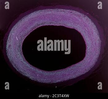 Cross section of animal Aorta, the main artery, microscope view Stock ...
