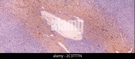 Mammal Suprarenal, Adrenalin gland, microscope view Stock Photo - Alamy