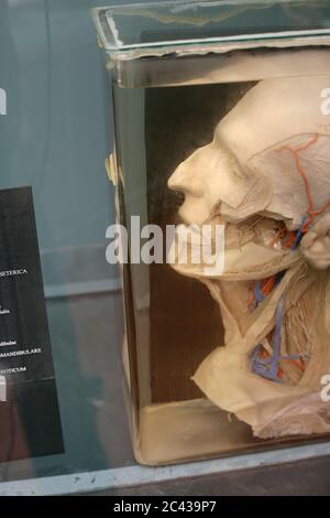 Head preserved in fluid with highlighted veins and veins - Anatomy ...