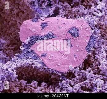 Foot bacteria. Scanning electron micrograph (SEM) of bacteria that live ...