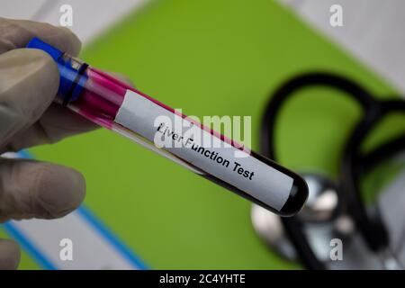 Liver Enzyme - Test with blood sample. Top view isolated on office desk ...