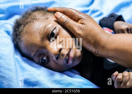 Malnourished boy James-Domenik (5) in the hospital in Tamale / Ghana ...