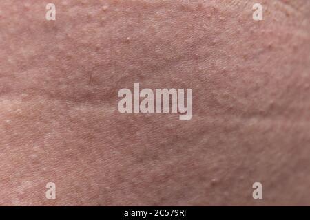 skin stretch Stock Photo - Alamy