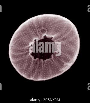 Sea urchin, X-ray Stock Photo - Alamy