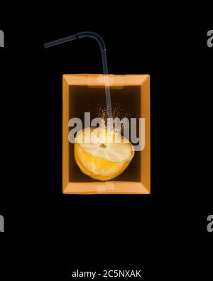 Coloured X-ray in side view (right) and front view (left) of the left ...