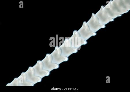 captive Tapeworm (Cestoda (Cestoidea)) is a parasitic flatworm (genus ...