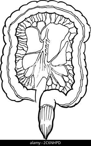 Appendicitis line icon. Human colon with inflamed appendix drawing ...