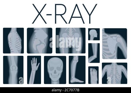 Vector realistic X-ray skeleton icons set. Human Skeleton xray elements ...