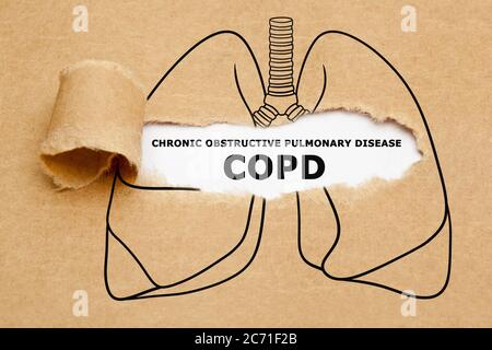 Chronic Obstructive Pulmonary Disease (COPD Stock Photo - Alamy