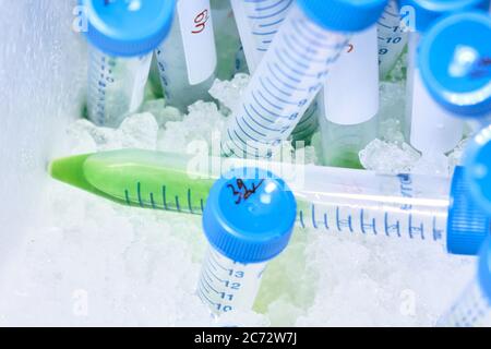 A urine sample in a plastic container with a reagent strip set on a ...