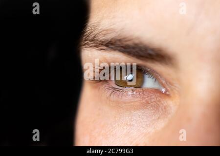 Macro eye photo. Keratoconus - eye disease, thinning of the cornea in ...