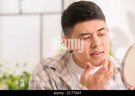 Asian man with cold sore applying ointment on his lips against white ...