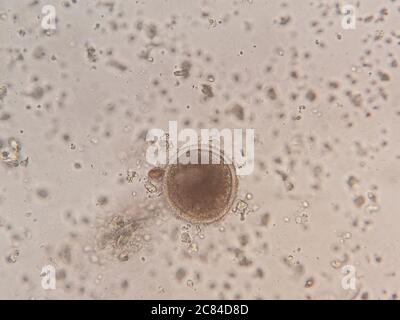 toxocara cati ova Stock Photo - Alamy