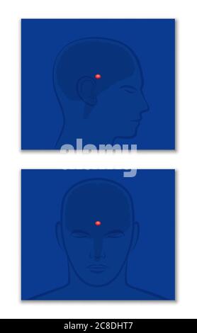 Pineal gland. Profile and frontal view with location in the human brain ...