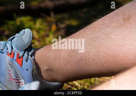 Naturally hairy woman legs. Blue sneakers Stock Photo - Alamy