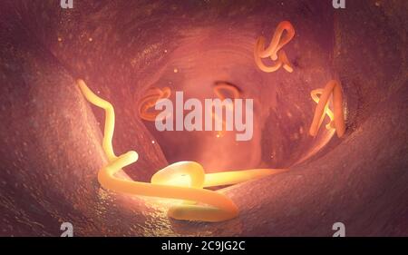 Illustration of a tapeworm in a human intestine. Tapeworms (Taenia sp ...
