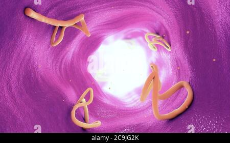 Illustration of a tapeworm in a human intestine. Tapeworms (Taenia sp ...