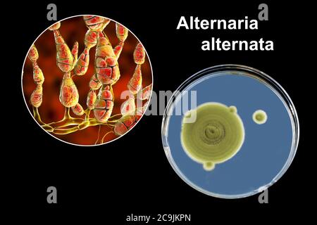 Filamentous allergenic fungus Alternaria alternata, computer ...