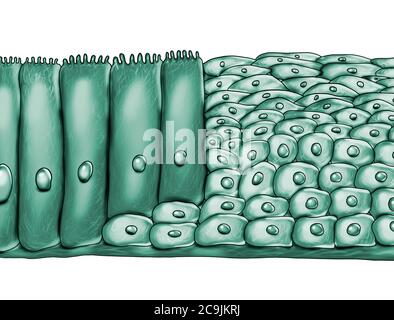 Epithelial metaplasia, computer illustration. Metaplasia is a change of ...