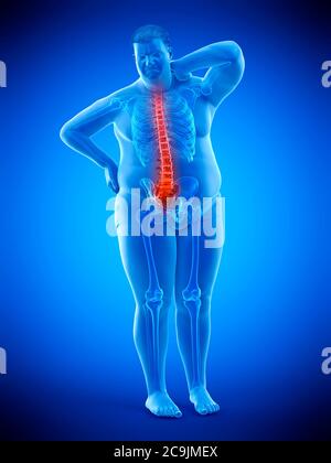 Obese man with back pain, computer illustration Stock Photo - Alamy
