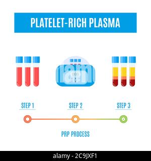 Platelet-rich plasma (PRP) composition, illustration Stock Photo - Alamy