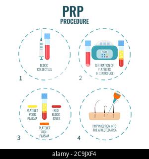Platelet-rich plasma (PRP) treatment, conceptual illustration Stock Photo - Alamy