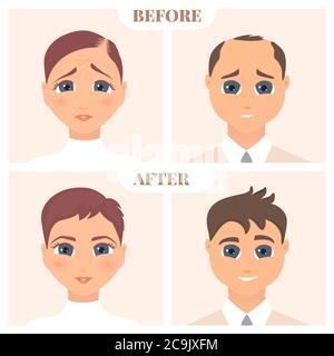Female and male alopecia treatment, illustration Stock Photo - Alamy
